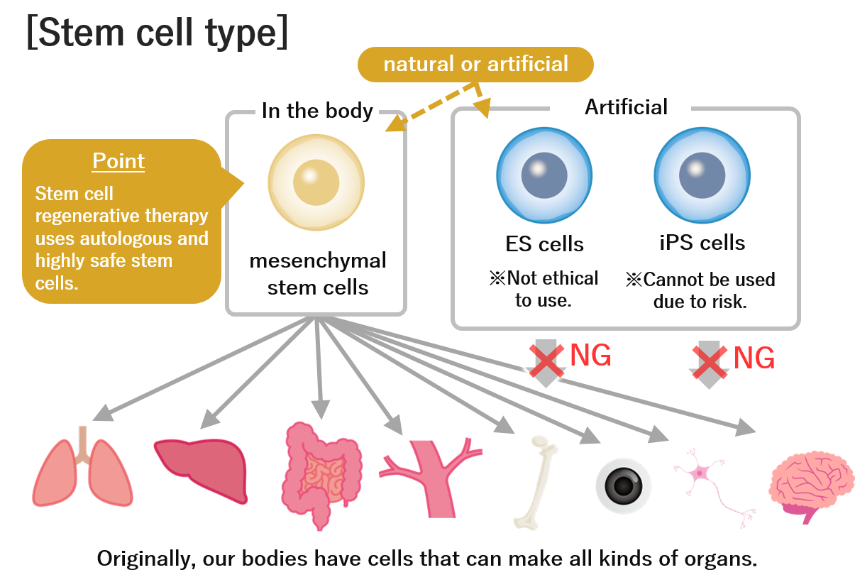 What is stem cell regenerative therapy? Detailed explanation of ...